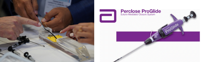 Mechaninė kraujagyslių uždarymo sistema PERCLOSE PROGLIDE™ - Bonameda